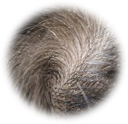 Zelfcheck - Is een behandeling nodig? Heb ik hoofdluis?